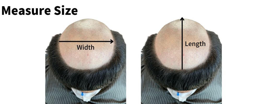 6“ Mens Lace Hair System | Reality Look and Natural Hairline