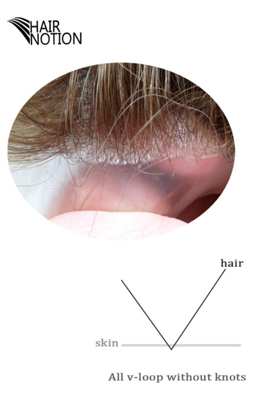 Mastering the Art of V-Loop Thin Skin Hair Systems
