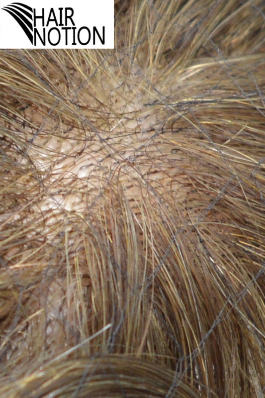 Hairnotion Postiche Homme Super Mince Peau Natural Toupee Cheveux