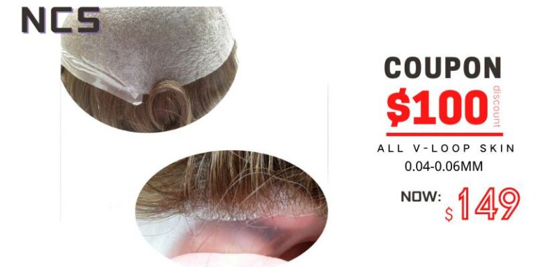 Celebrity Hair System Secrets: Famous Stars Who Wear Hairpieces and ...