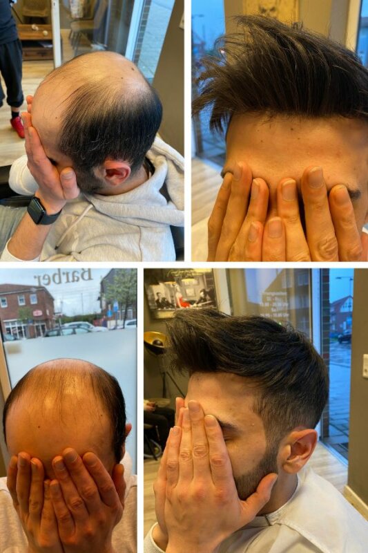 Toupee, Buyer's Guide to Quality Toupees: Navigating Choices and Value ...