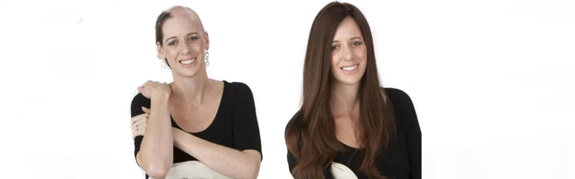 Custom Medical Wig | No.1 Virgin Hair Wigs For Cancer Patients