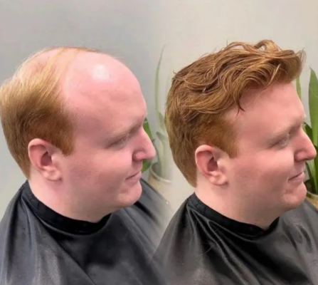 Wig Woes: How to Keep Your Toupee From Falling Off and Avoid a Fashion ...